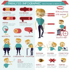 Paralysis infographic healthcare and medical free image download