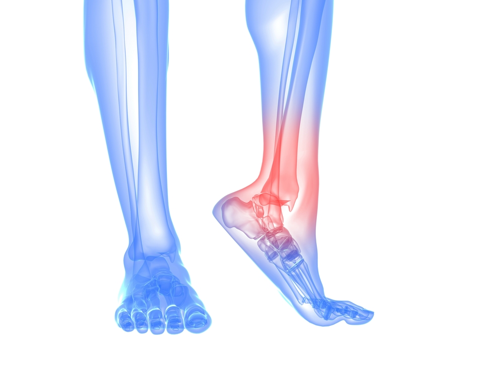 Drawing of a damaged leg free image download